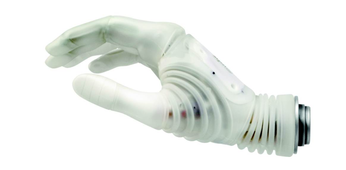 Michelangelo Hand – ORTHOPÄDIE – ZENTRUM Striede